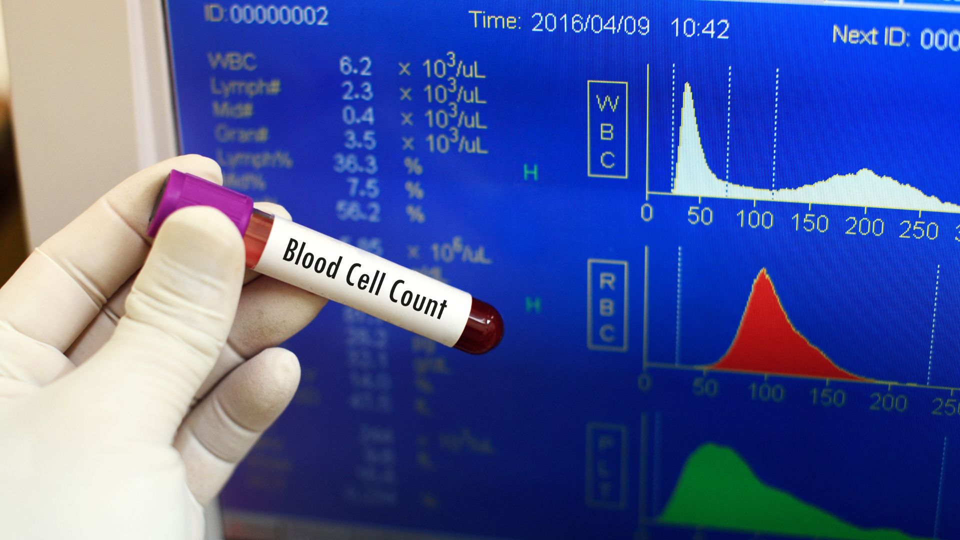Market Growth Dynamics Within Cell Counting Systems Market Global
